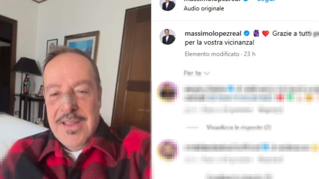 Massimo Lopez investito a Roma, "Mi è andata di lusso"